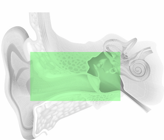 Types of Hearing Loss - Sound Advice Hearing Ltd